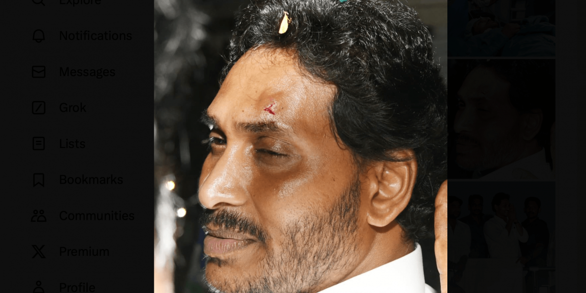 Election Commission Seeks Report On Alleged Attack On Jaganmohan Reddy